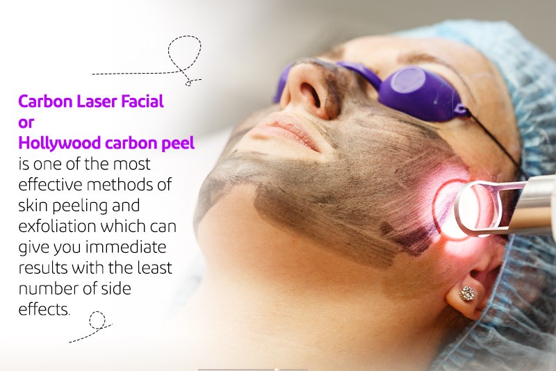 Hollywood Peeling Facial with Carbon Laser - Hannah Spa